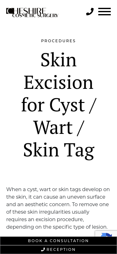 cheshirecosmeticsurgery.com/treatments/mole-cyst-wart-skin-tag-excision ...